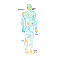 SPRINT PNS System - OPTIM Health System