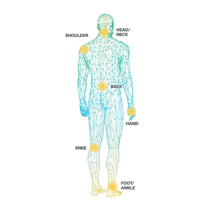 SPRINT PNS System - OPTIM Health System