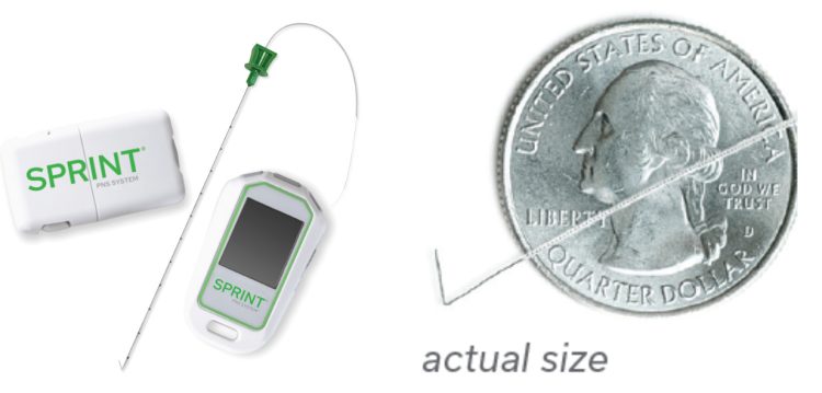 SPRINT PNS System - OPTIM Health System