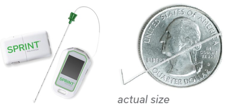 SPRINT PNS System - OPTIM Health System